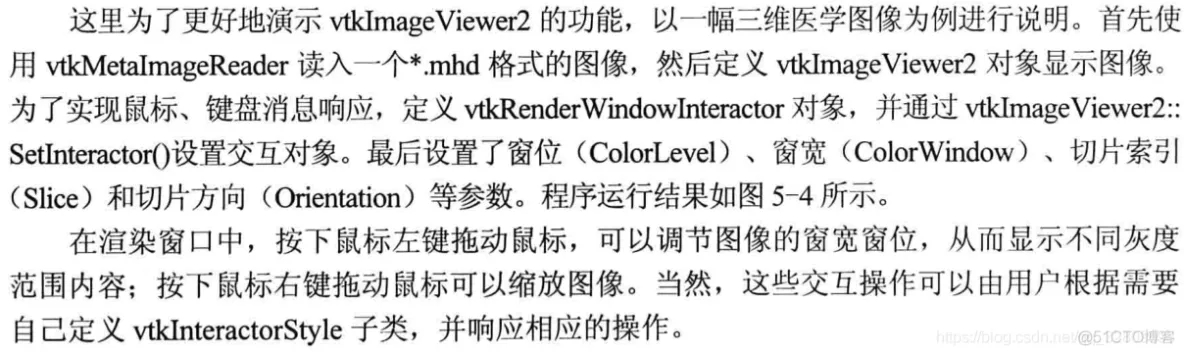 VTK 实例20：用vtkImageViewer2显示三维医学图像mhd的某个切面 - 一杯清酒邀明月 - 博客园