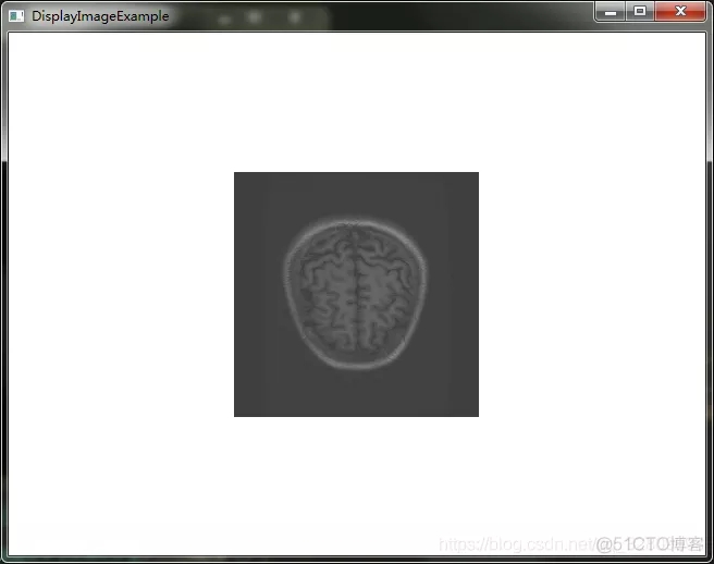 VTK 实例20：用vtkImageViewer2显示三维医学图像mhd的某个切面 - 一杯清酒邀明月 - 博客园