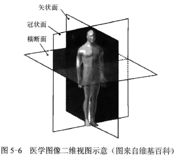VTK 实例20：用vtkImageViewer2显示三维医学图像mhd的某个切面 - 一杯清酒邀明月 - 博客园