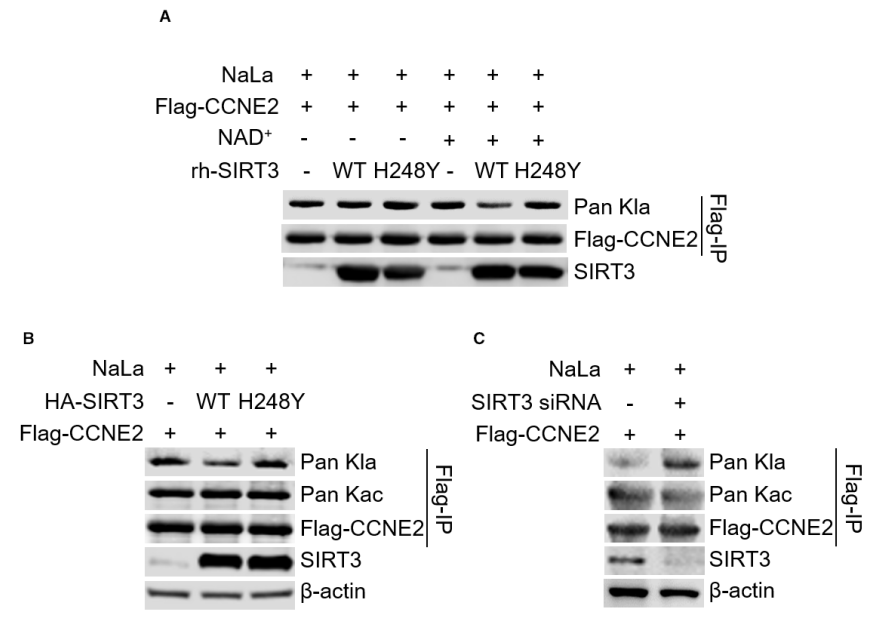 EMBO Rep | 中国科学技术大学王毅团队揭示CCNE2乳酸化修饰促进肝细胞癌进展的新机制 - PTMBio - 博客园