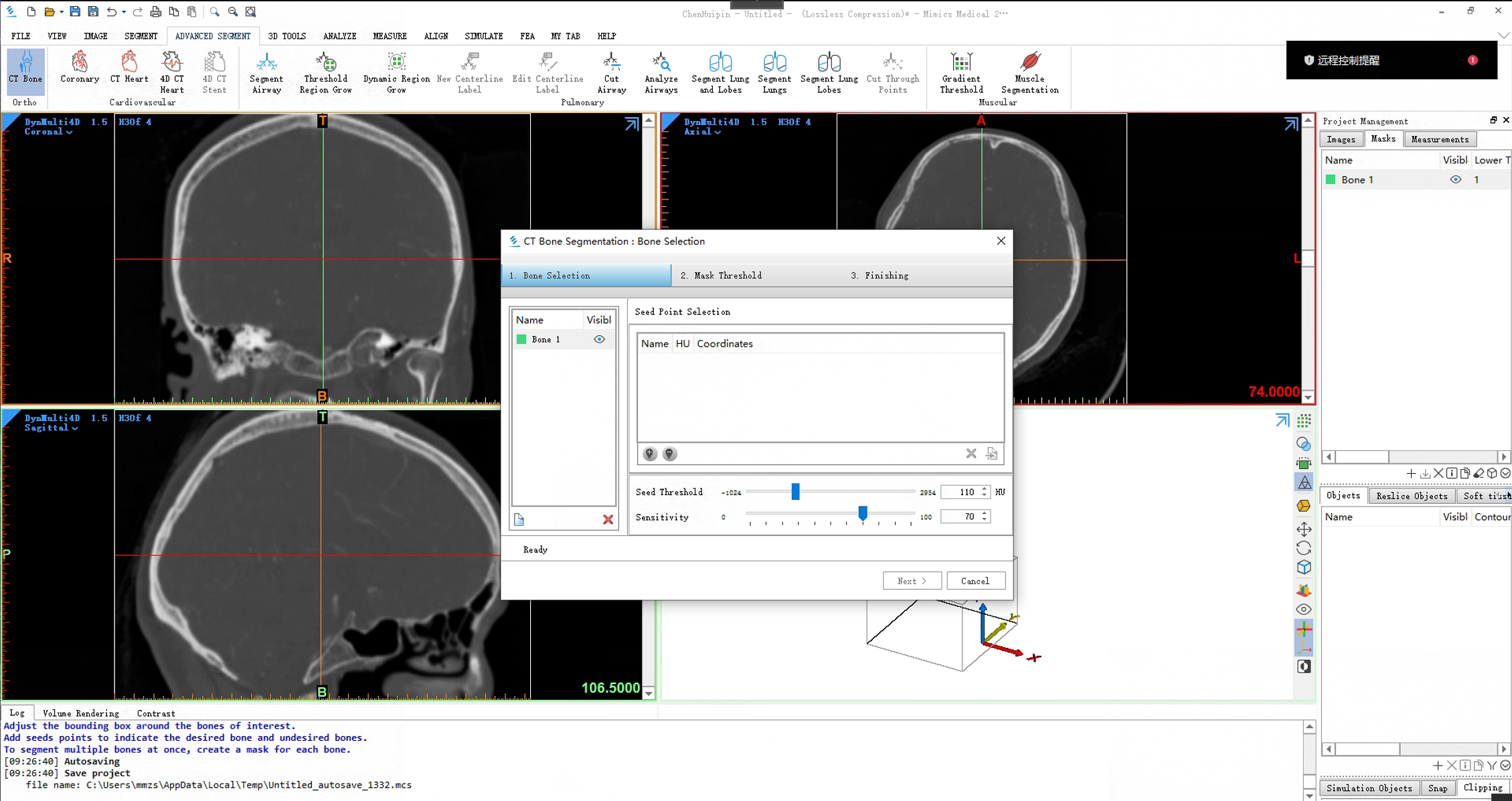 Mimics 软件简单使用 - Ray-Z - 博客园