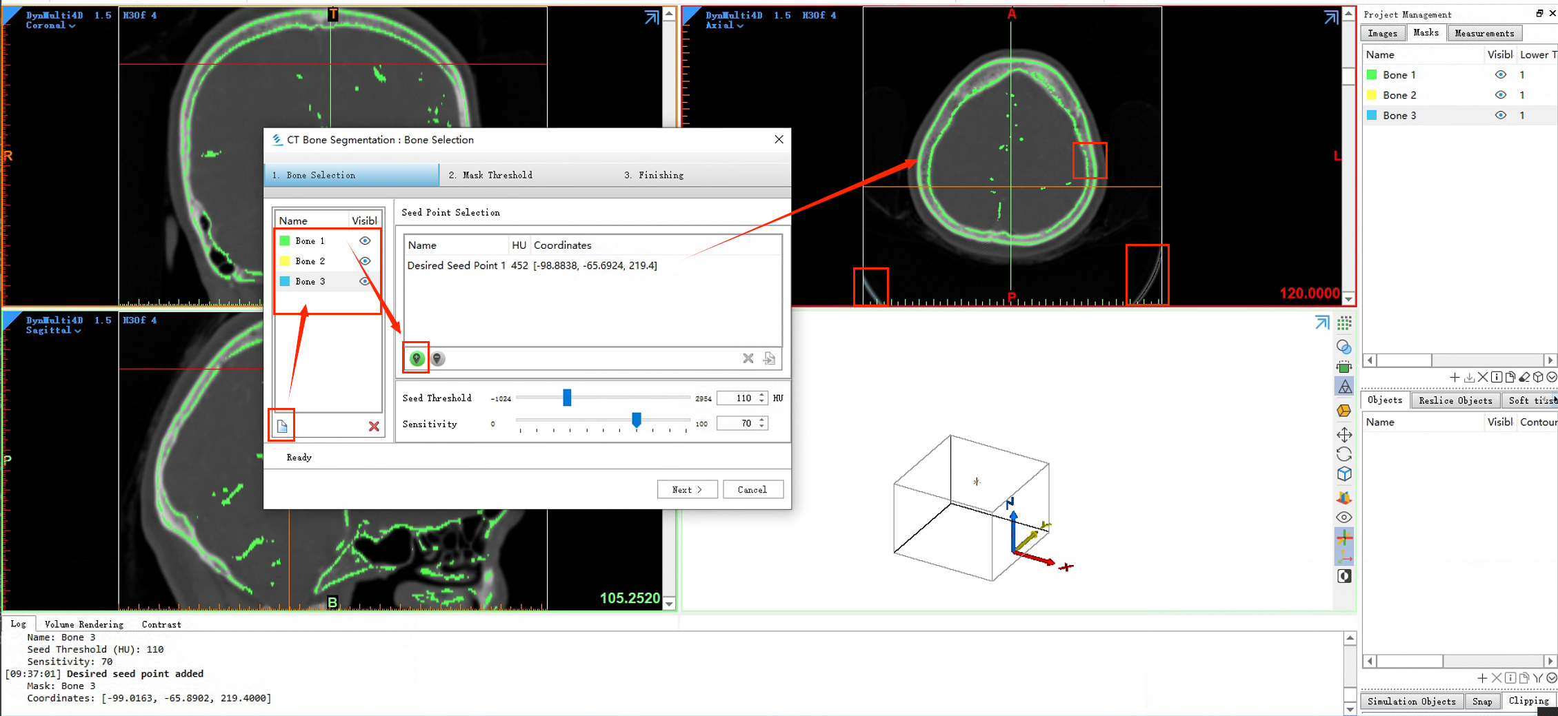 Mimics 软件简单使用 - Ray-Z - 博客园