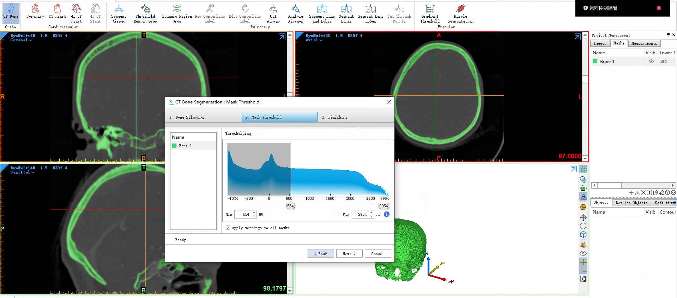 Mimics 软件简单使用 - Ray-Z - 博客园