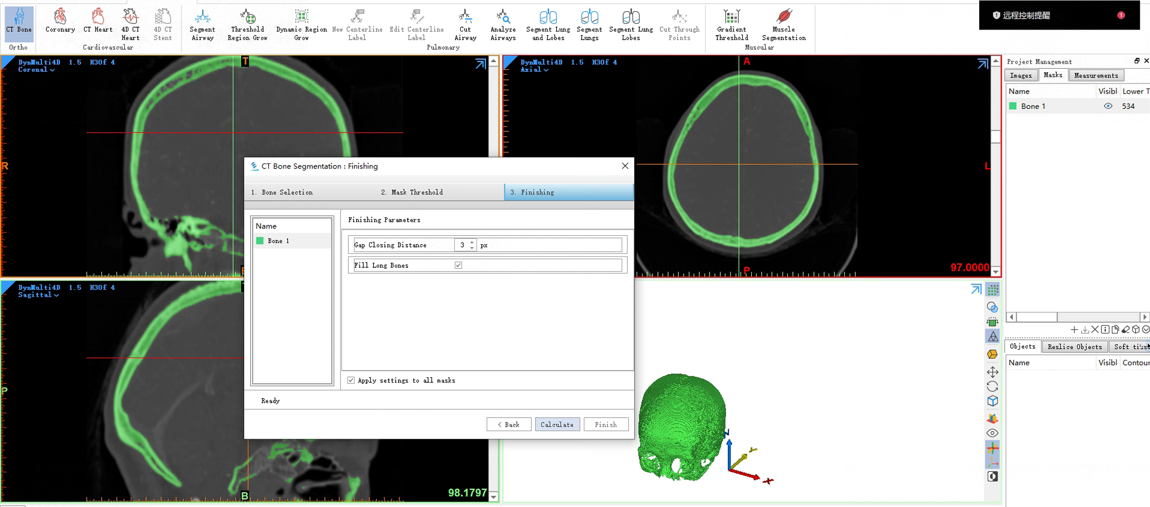 Mimics 软件简单使用 - Ray-Z - 博客园