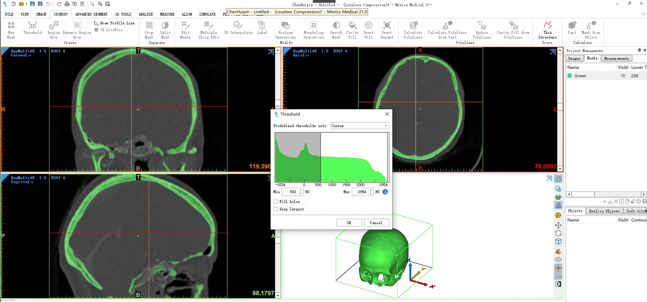Mimics 软件简单使用 - Ray-Z - 博客园