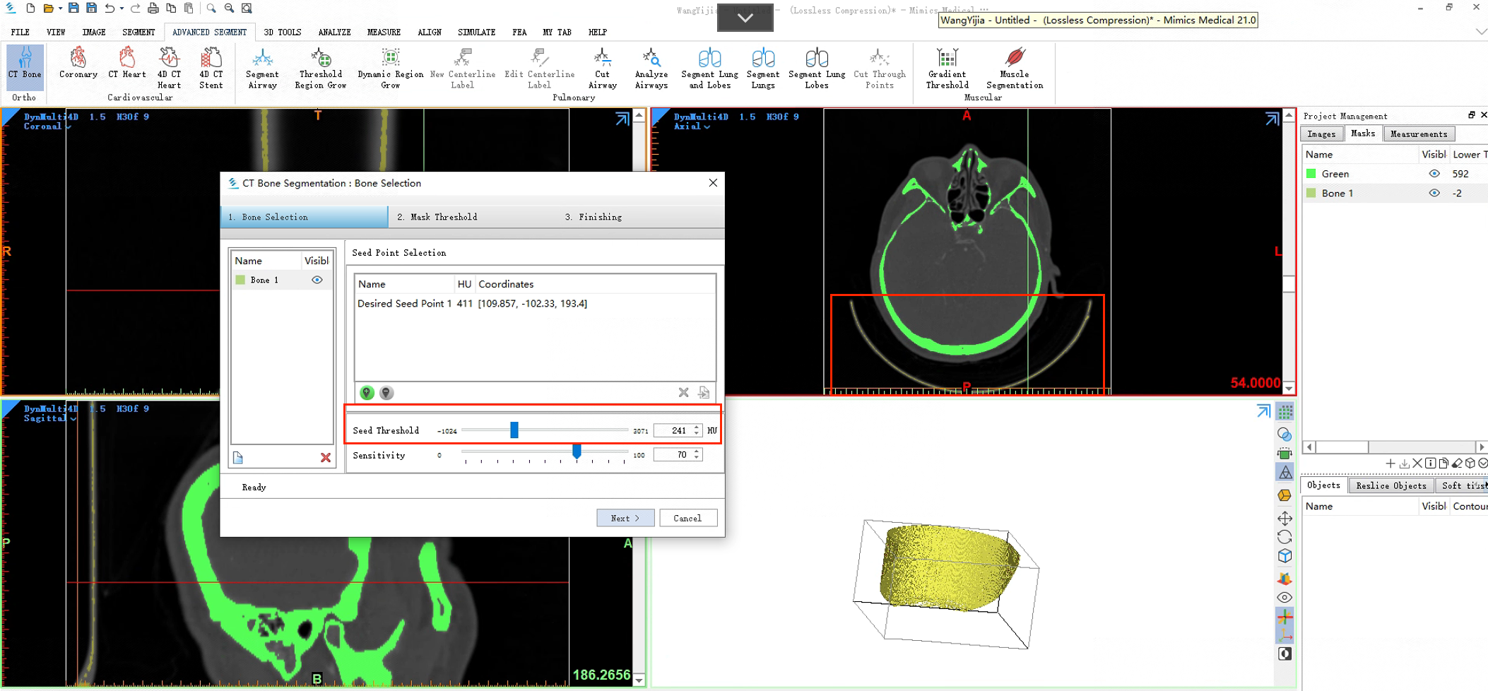 Mimics 软件简单使用 - Ray-Z - 博客园