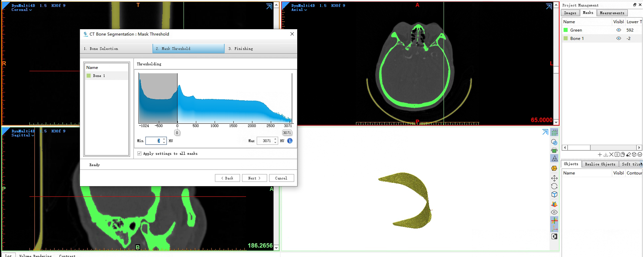 Mimics 软件简单使用 - Ray-Z - 博客园